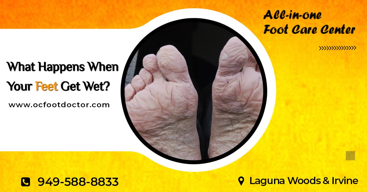 What Happens When Your Feet Get Wet and Stay Wet?