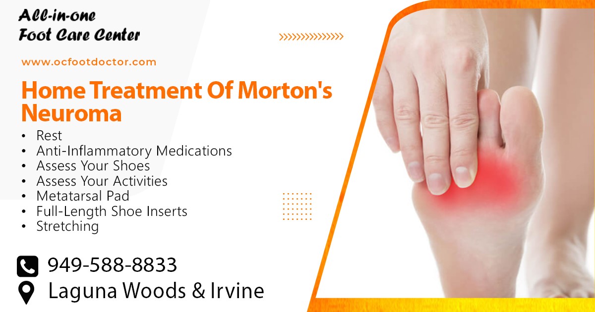 Home Treatment Of Morton's Neuroma