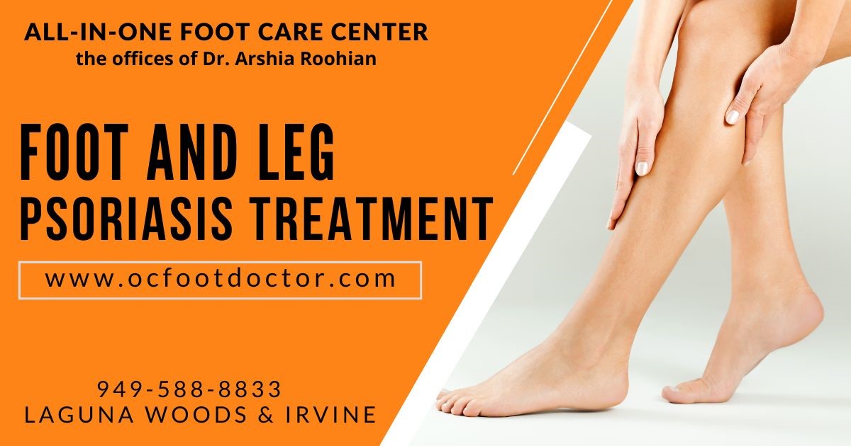 Foot and Leg Psoriasis Treatment