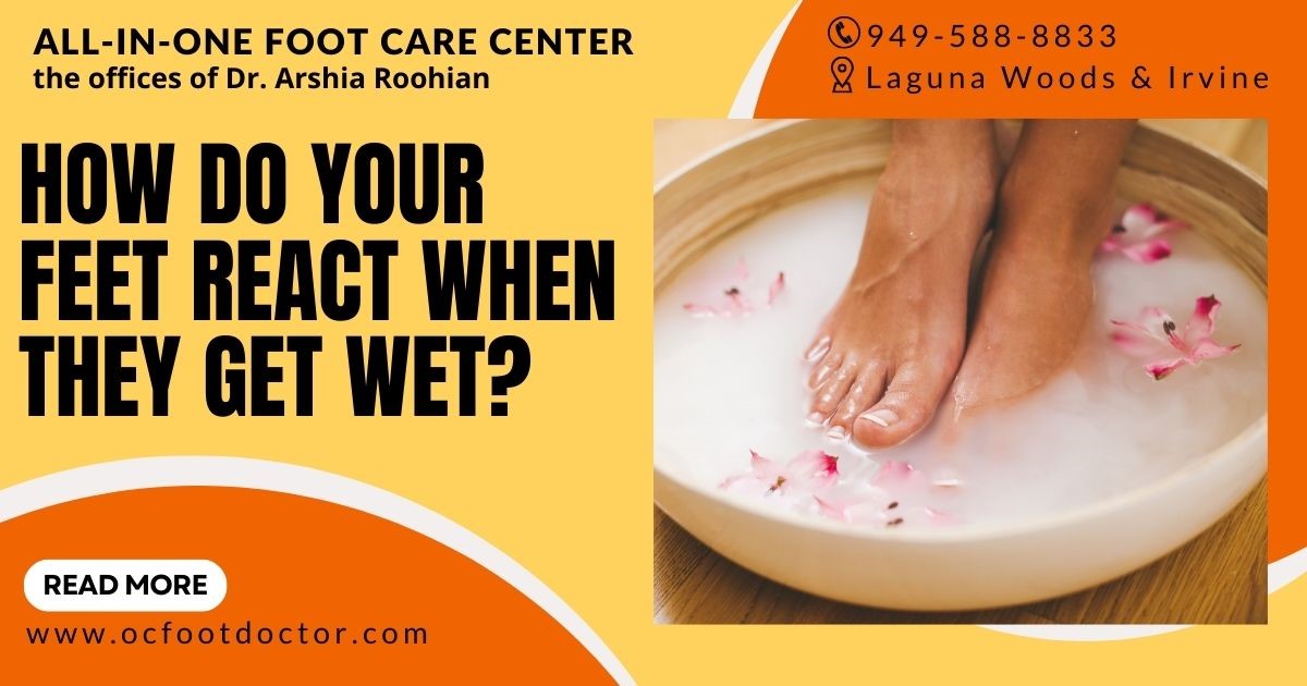 How Do Your Feet React When They Get Wet?