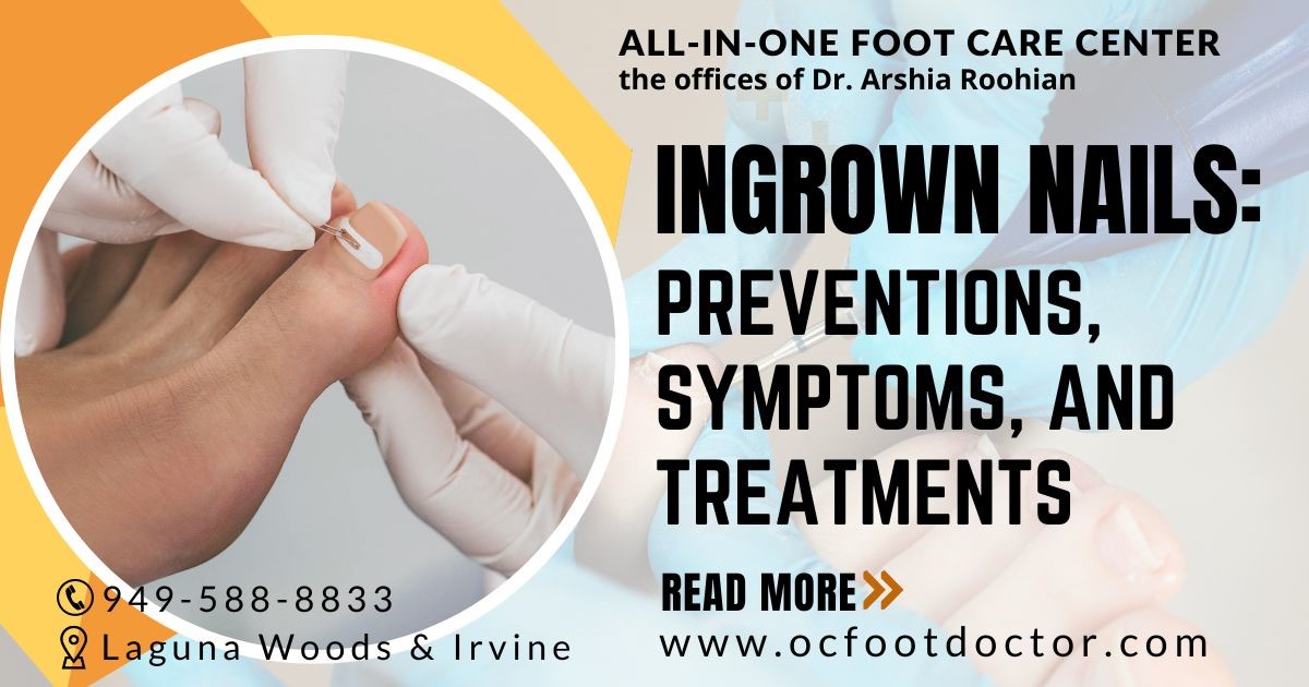 Ingrown Nails: Preventions, Symptoms, and Treatments