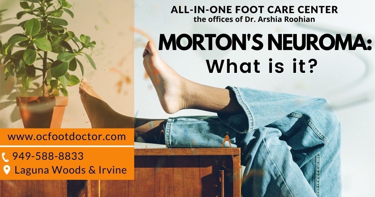 Morton's Neuroma: What is it?