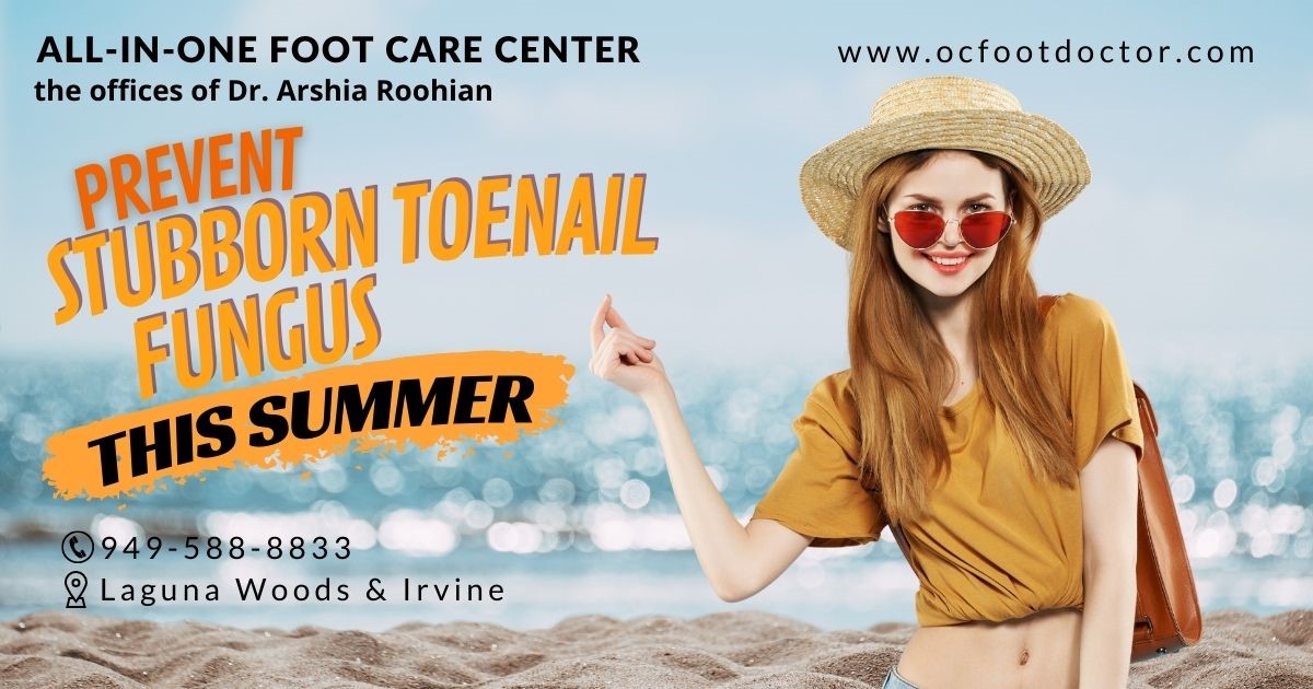 Prevent Stubborn Toenail Fungus This Summer