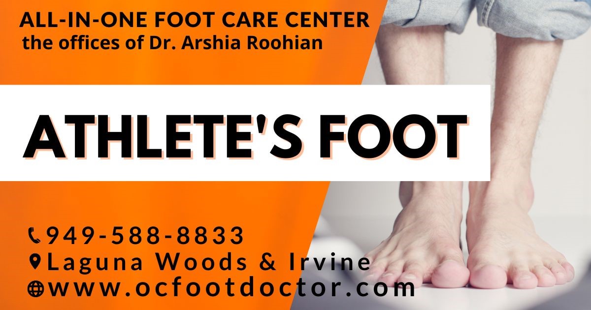 The Basics of Athlete's Foot