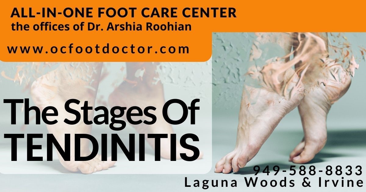 The Stages Of Tendinitis