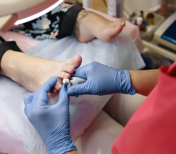 Understanding & Treating Common Toenail Conditions