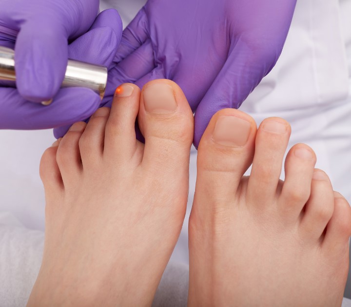 Understanding & Treating Common Toenail Conditions